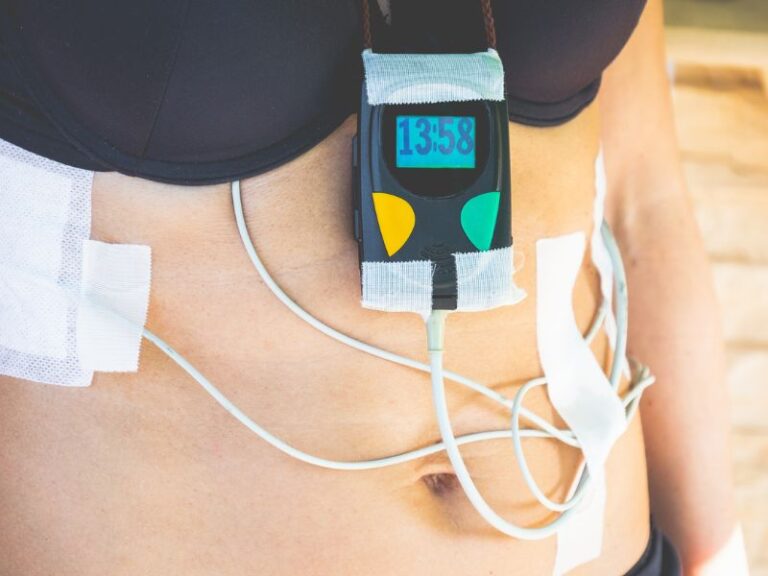 Como é o Exame MAPA 24 Horas? Etapas e Por Que Fazer