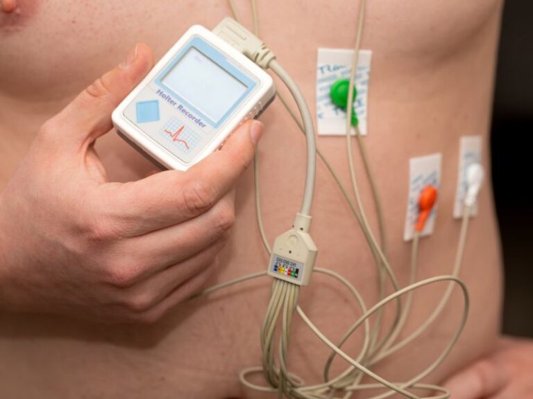 O Que É Holter 24h e Como Esse Exame Protege Seu Coração